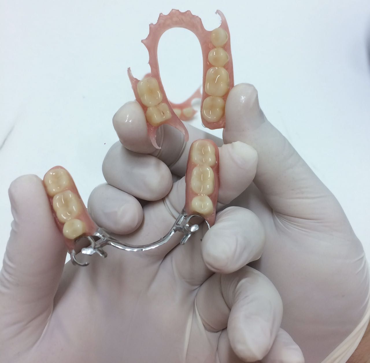 Prótese Flexível – Clínica Odontologica do Trabalhador